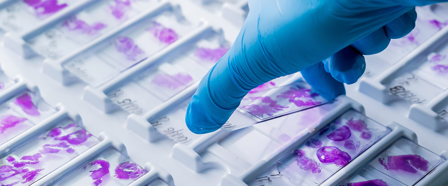 BIOMEX: Your specialist for human biospecimens