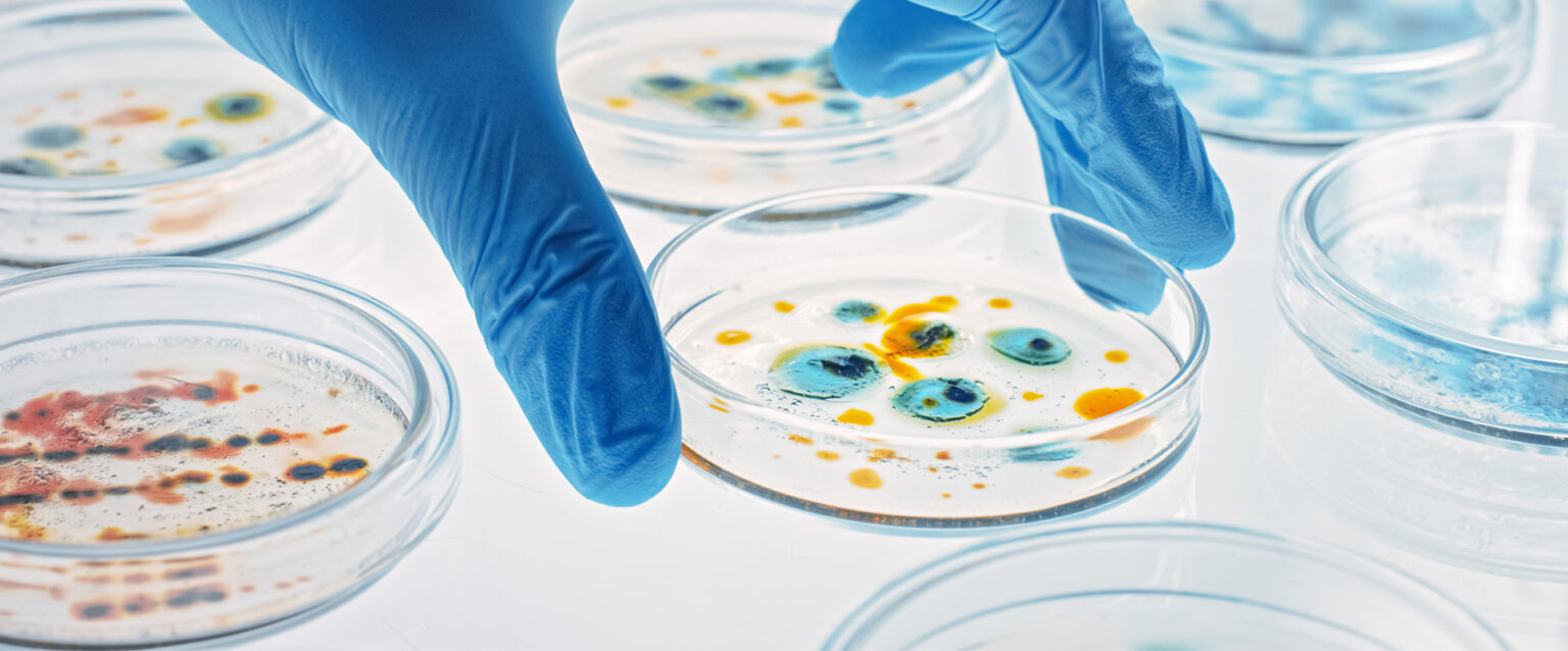 BIOMEX: Your specialist for human biospecimens